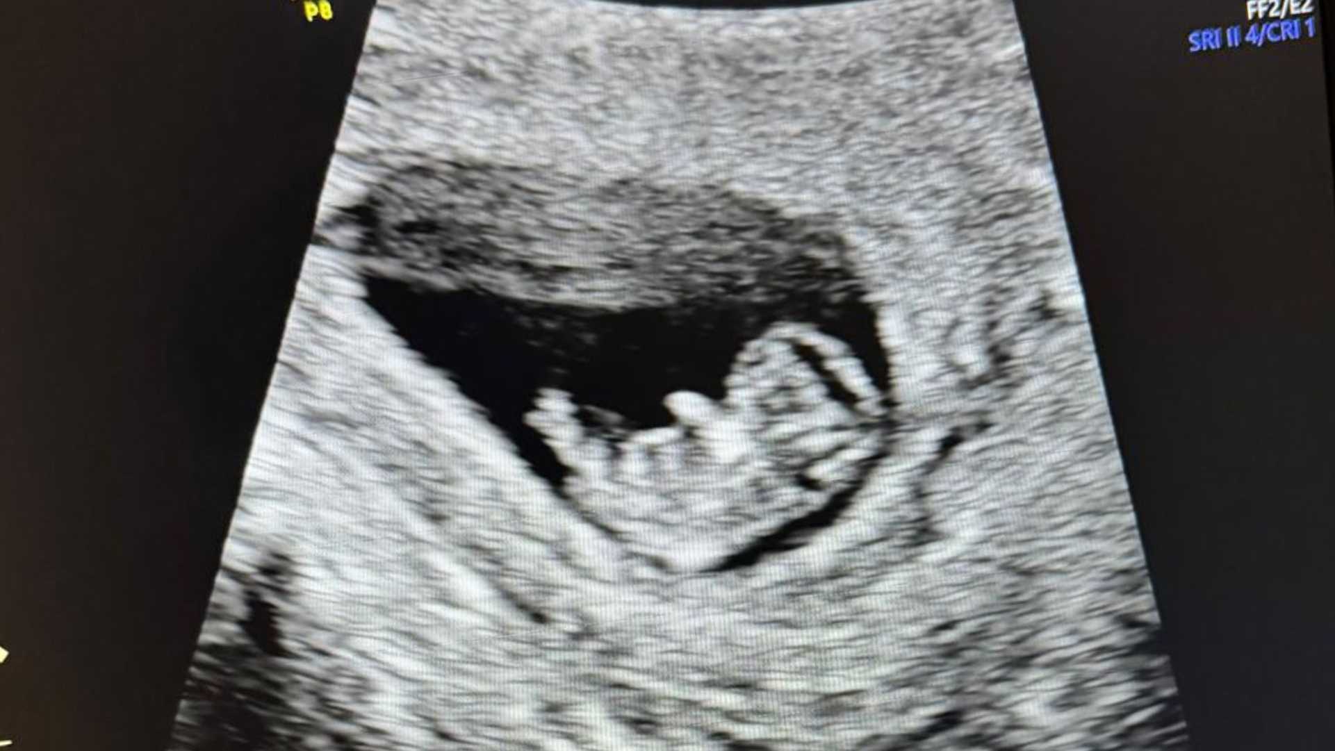 Gender Scan